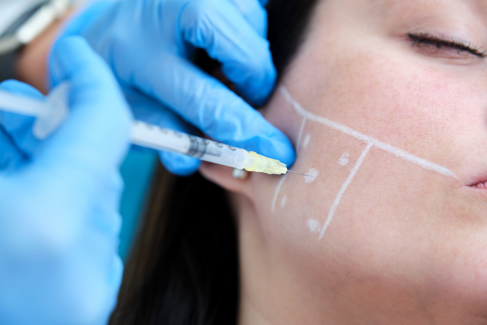 Masseter (Bruxismus) Zähneknirschen Behandlung mit Botox in Frankfurt ...